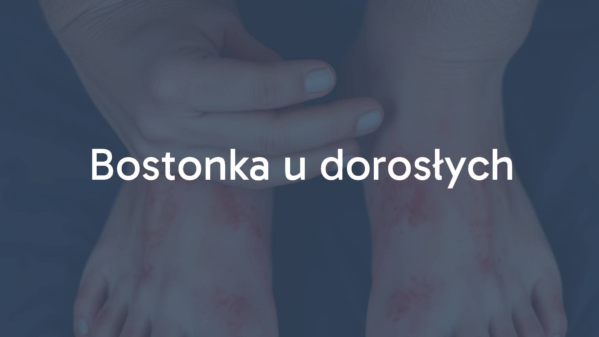 Bostonka u dorosłych - Dobrowolnie.pl